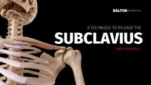The Sternoclavicular Joint: The Missing Link in Shoulder Pain Treatment